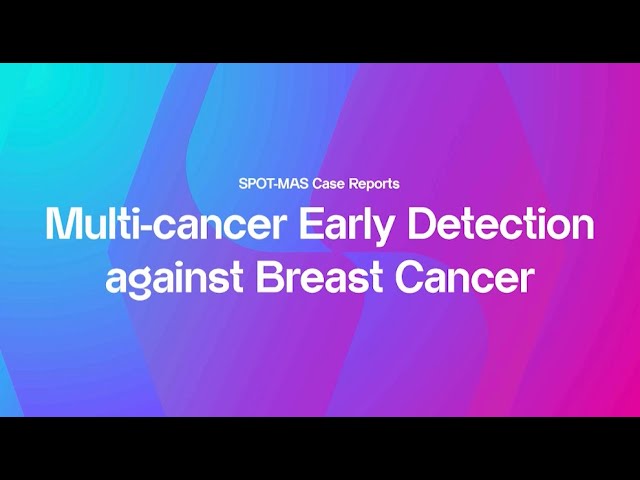 Video: Multi-cancer early detection against breast cancer - SPOT-MAS